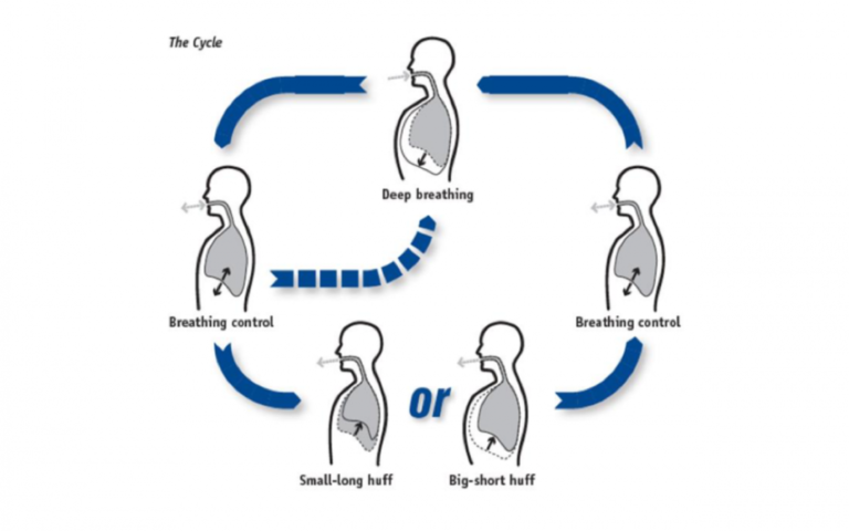 Active Cycle Breathing Technique - Teknik Untuk Membantu Pengeluaran ...